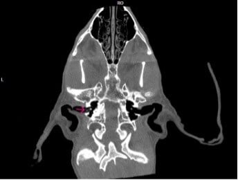 Ear Disease and Video Otoscopy | Animal Dermatology Group